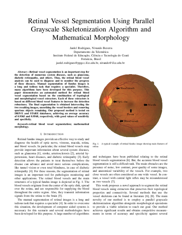 (PDF) Retinal Vessel Segmentation Using Parallel Grayscale Skeletonization Algorithm and ...