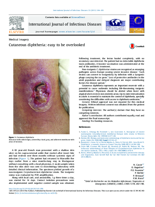 (PDF) Cutaneous diphtheria: easy to be overlooked