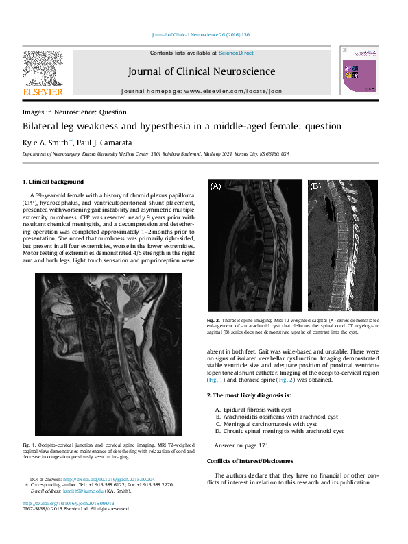 (PDF) Bilateral leg weakness and hypesthesia in a middle-aged female ...