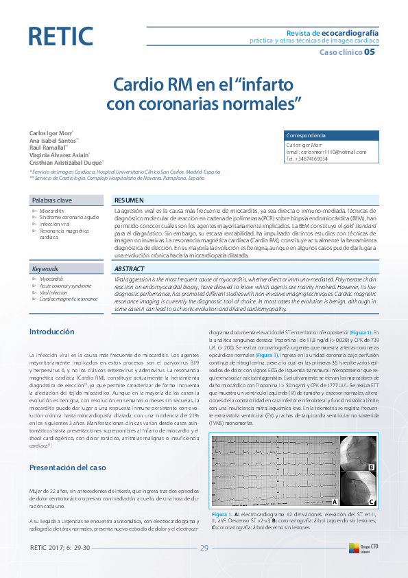 (PDF) Cardio RM en el “infarto con coronarias normales” | virginia Alvarez Asiain - Academia.edu