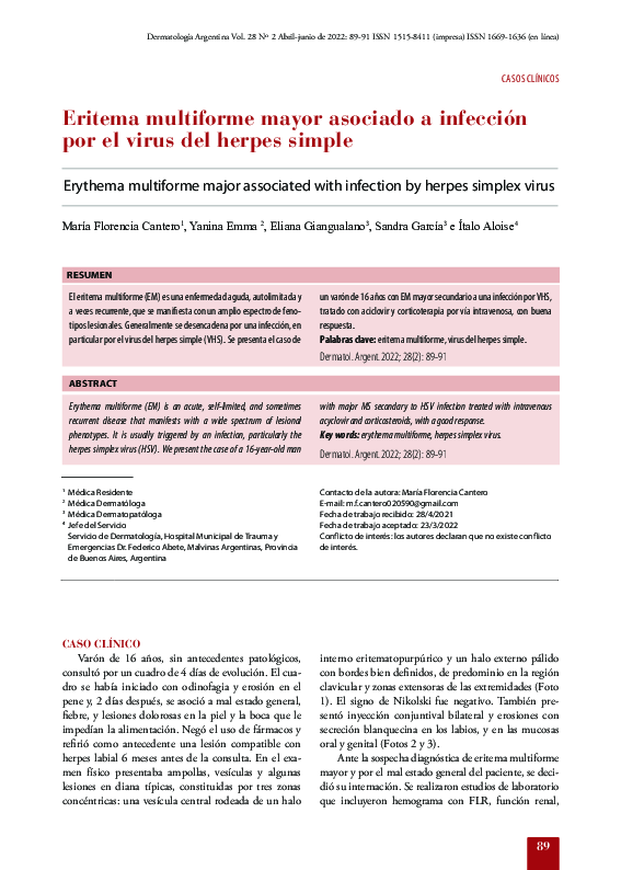 (PDF) Eritema multiforme mayor asociado a infección por virus herpes simple