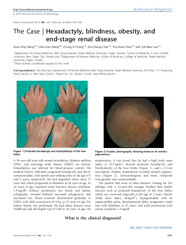 (PDF) The Case | Hexadactyly, blindness, obesity, and end-stage renal ...