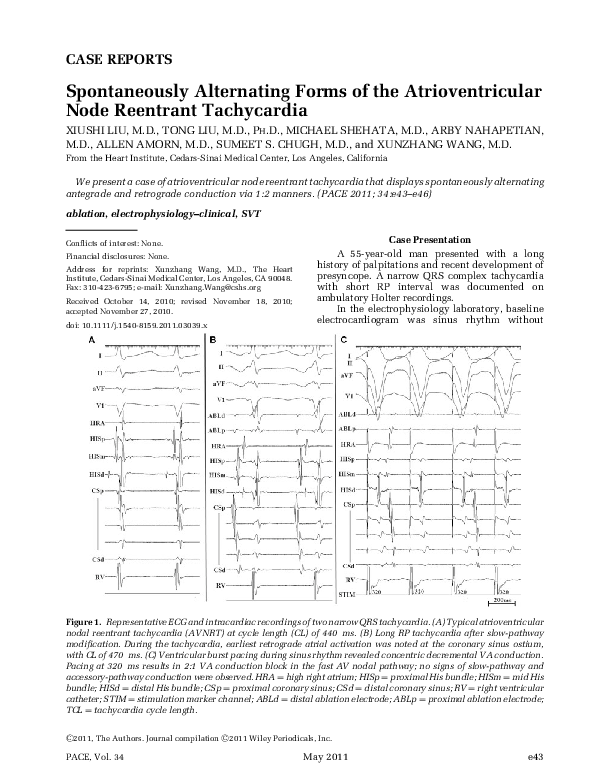 (PDF) Spontaneously Alternating Forms of the Atrioventricular Node Reentrant Tachycardia | Arby ...