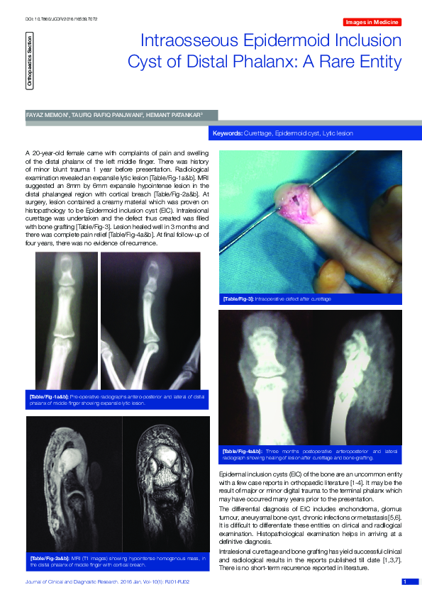 (PDF) Intraosseous Epidermoid Inclusion Cyst of Distal Phalanx: A Rare ...