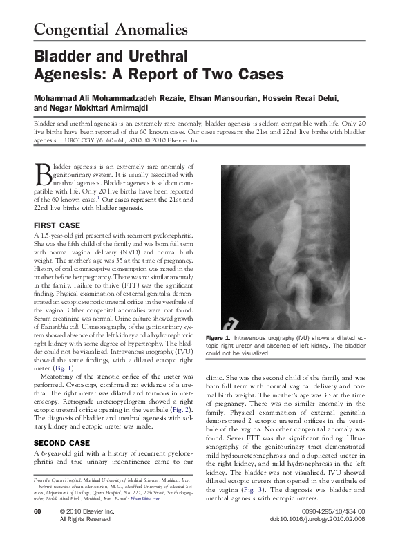 (PDF) Bladder and Urethral Agenesis: A Report of Two Cases