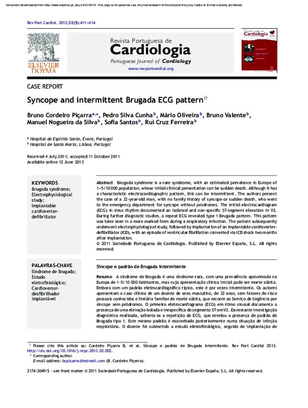 (PDF) Syncope and intermittent Brugada ECG pattern