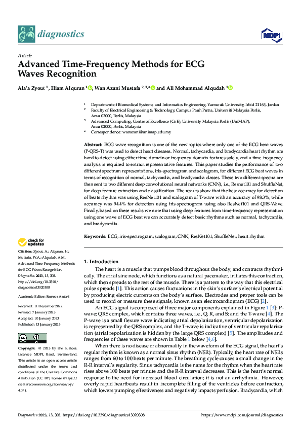 (PDF) Advanced Time-Frequency Methods for ECG Waves Recognition