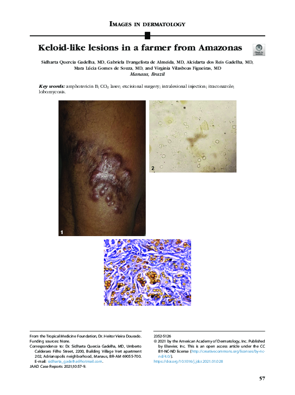 (PDF) Keloid-like lesions in a farmer from Amazonas