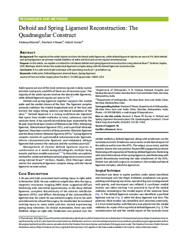 (PDF) Deltoid and Spring Ligament Reconstruction: The Quadrangular ...