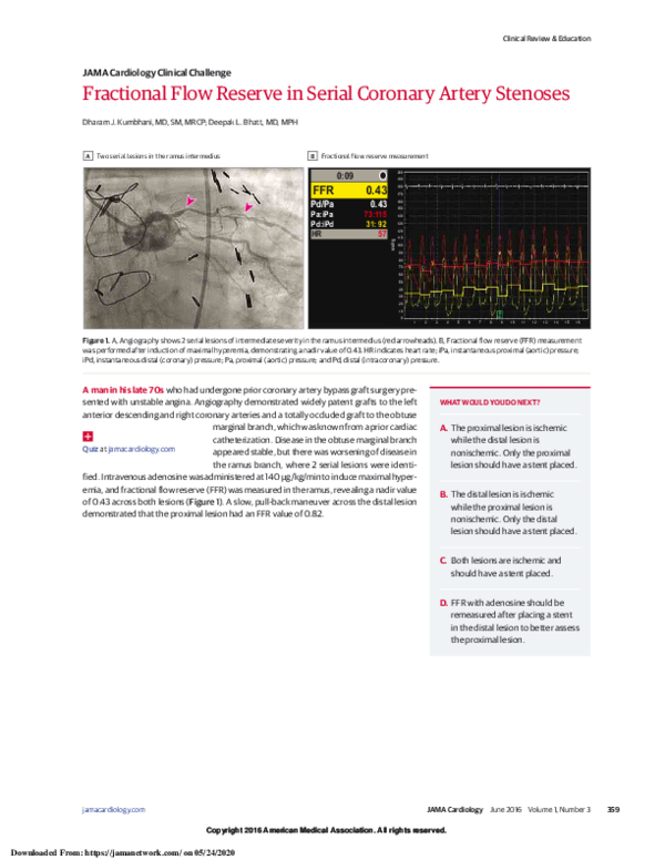 (PDF) Fractional Flow Reserve in Serial Coronary Artery Stenoses