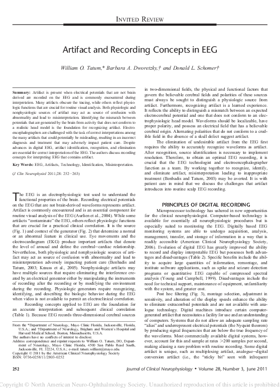 (PDF) Artifact and Recording Concepts in EEG