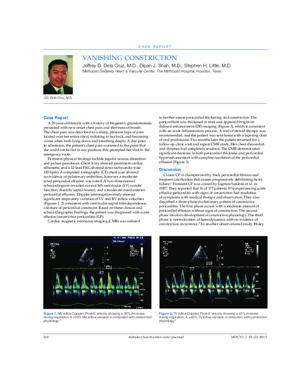 (PDF) Vanishing Constriction