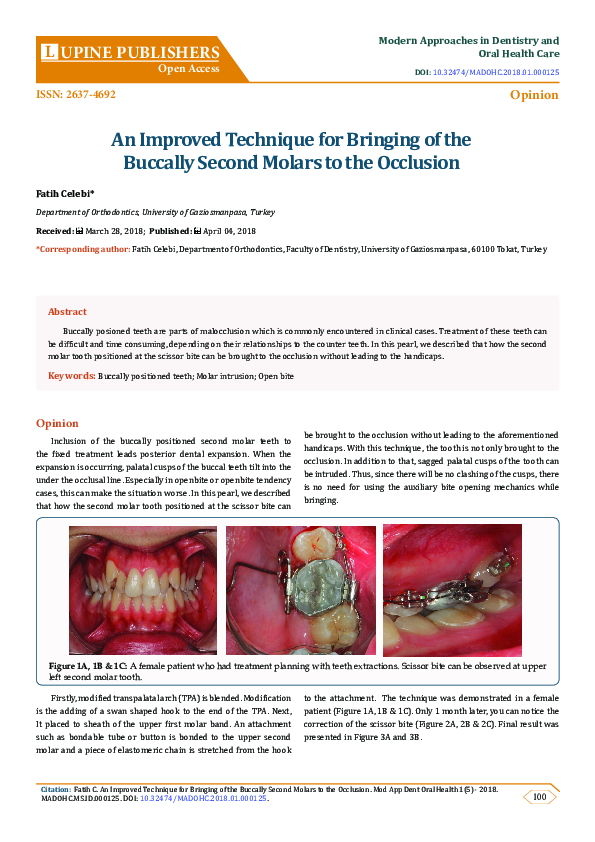 (PDF) An Improved Technique for Bringing of the Buccally Second Molars ...