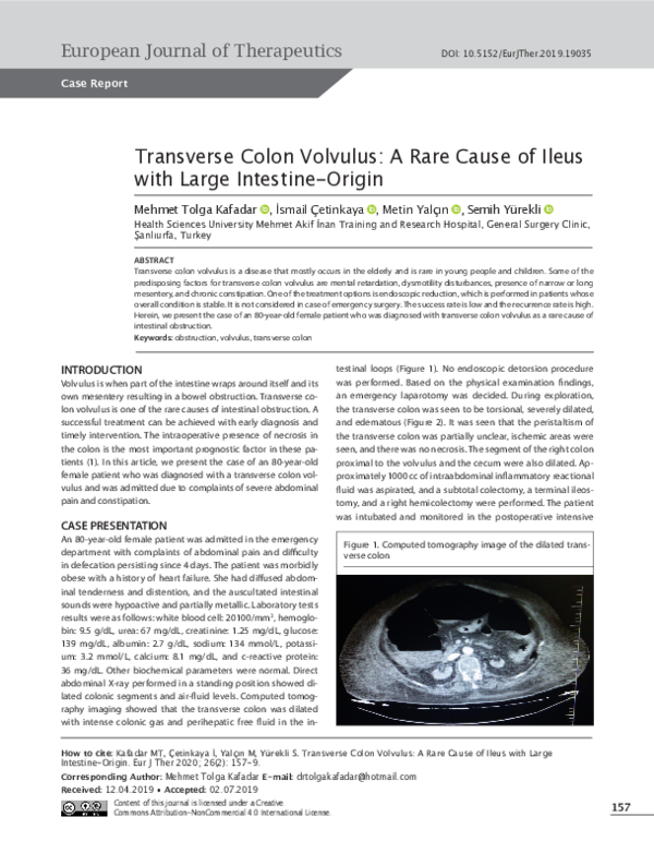 (PDF) Transverse Colon Volvulus: A Rare Cause of Ileus with Large ...