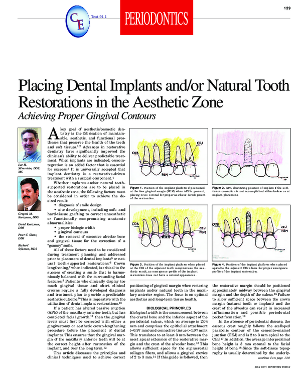 (PDF) Placing dental implants and/or natural tooth restorations in the ...