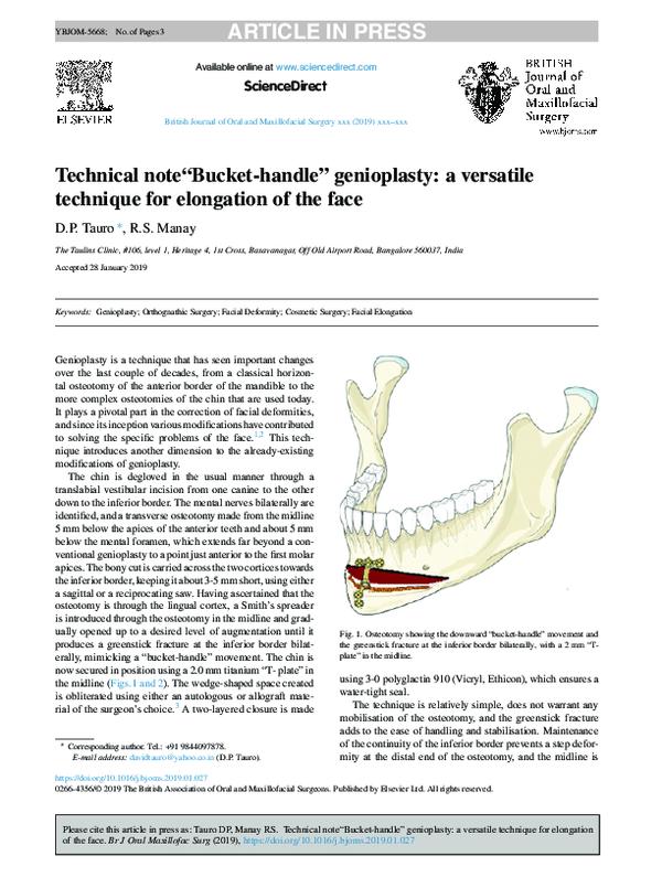 (PDF) Technical note“Bucket-handle” genioplasty: a versatile technique ...