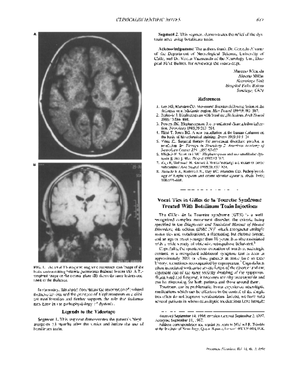 (PDF) Vocal tics in gilles de la tourette syndrome treated with ...
