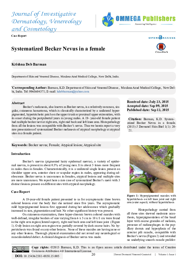 (PDF) Systematized Becker Nevus in a Female | KRISHNA BARMAN - Academia.edu