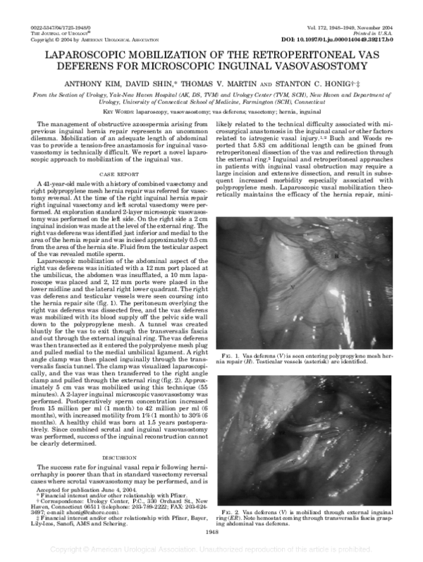 (PDF) Laparoscopic Mobilization of the Retroperitoneal Vas Deferens for ...