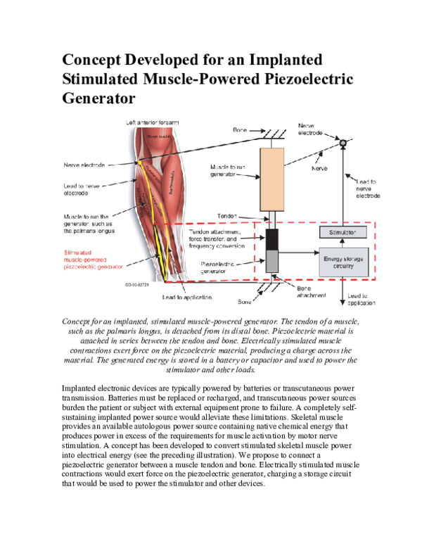 (PDF) Concept Developed for an Implanted Stimulated Muscle-Powered ...