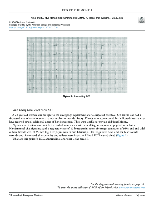 (PDF) Abnormal P wave and QRS Complex Axes: When Differential Diagnoses ...