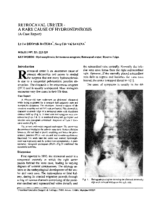 (PDF) RETROCAVAL URETER – A RARE CAUSE OF HYDRONEPHROSIS (A Case Report)