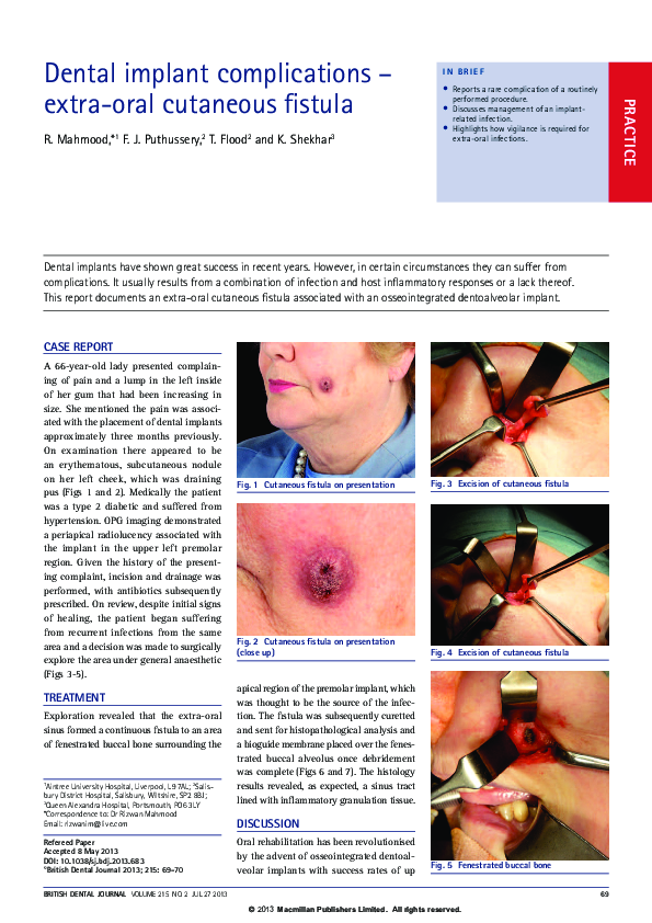 (PDF) Dental implant complications – extra-oral cutaneous fistula
