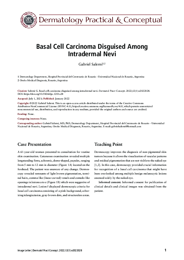 (PDF) Basal Cell Carcinoma Disguised Among Intradermal Nevi