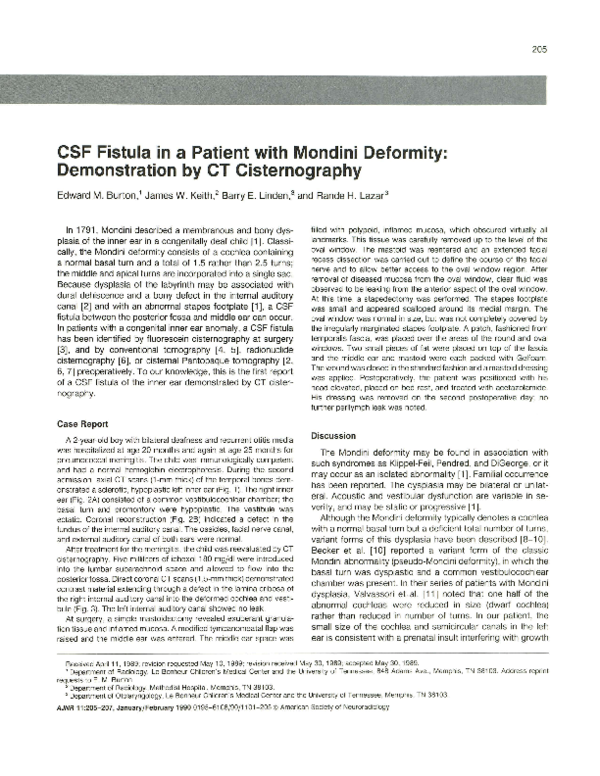 (PDF) CSF fistula in a patient with Mondini deformity: demonstration by ...