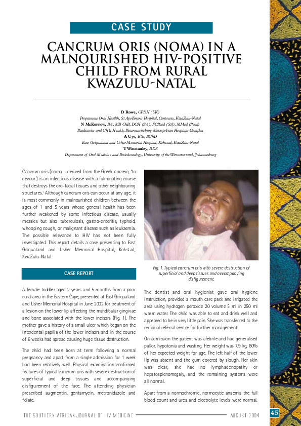 (PDF) Case Study: Cancrum oris (noma) in a malnourished HIV-positive ...