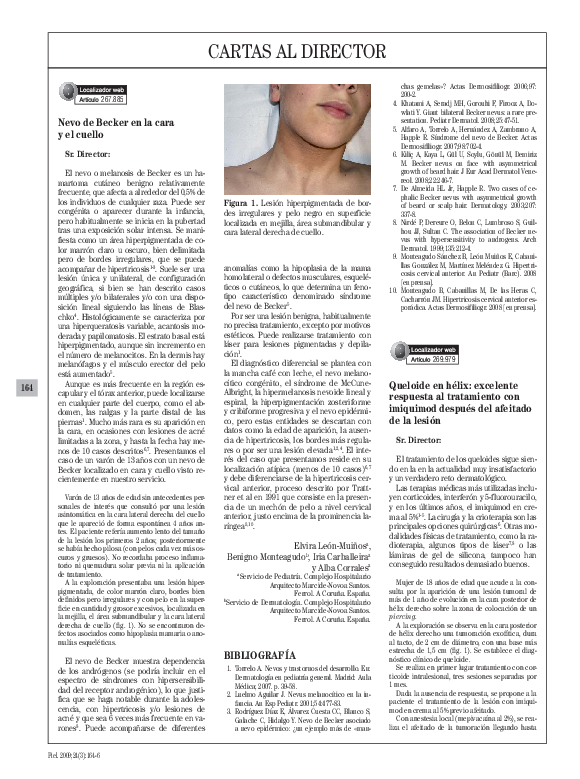 (PDF) Nevo de Becker en la cara y el cuello