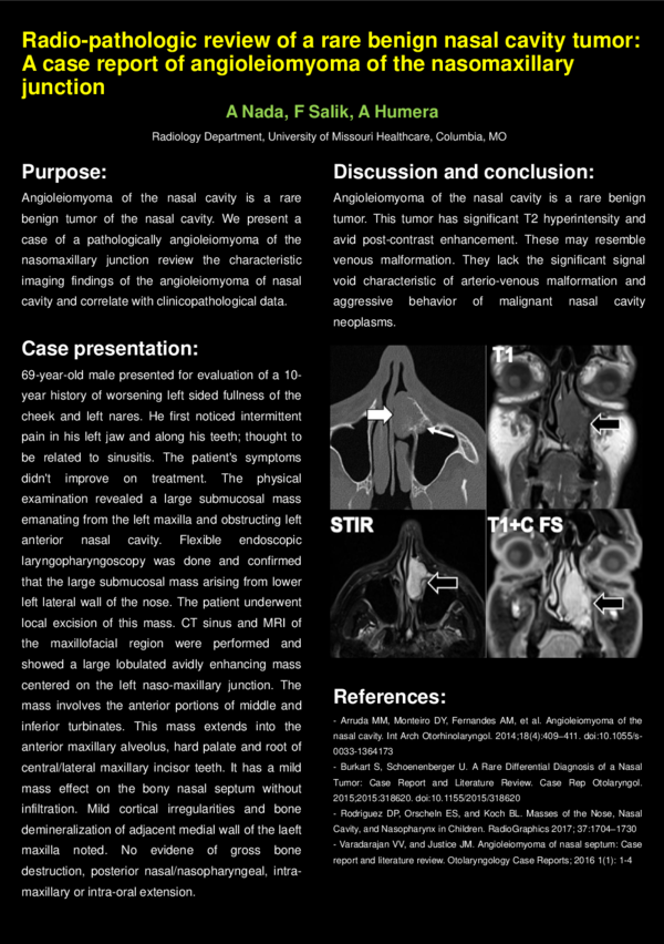 (PDF) Radio-pathologic review of a rare benign nasal cavity tumor: A ...