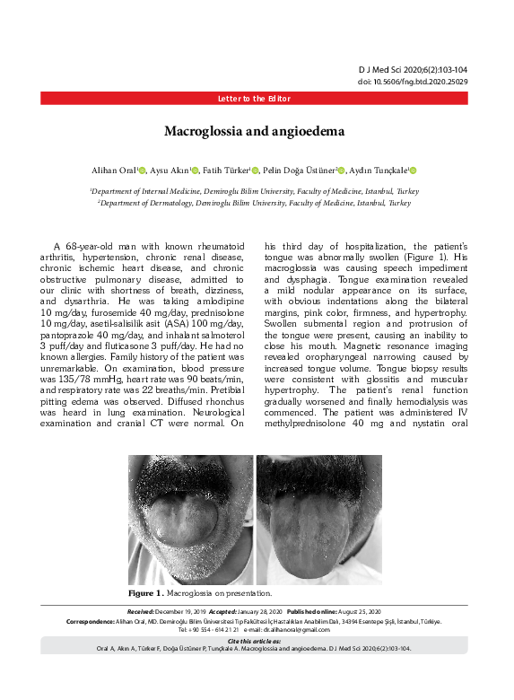 (PDF) Macroglossia and angioedema