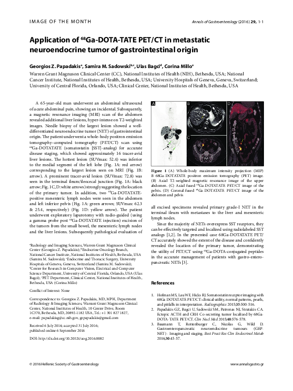 (PDF) Application of 68Ga-DOTA-TATE PET/CT in metastatic neuroendocrine ...