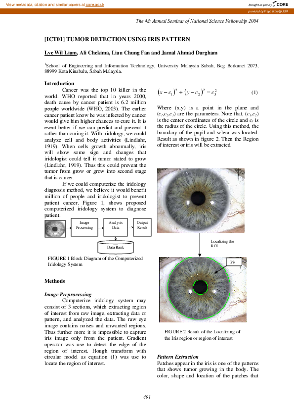 (PDF) Tumor detection using IRIS pattern