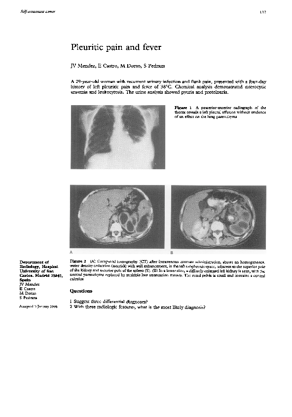 (PDF) Causes of Pleuritic Pain and Fever