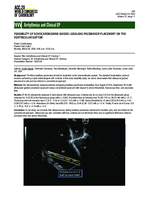 (PDF) Feasibility of Echocardiogram Guided Leadless Pacemaker Placement ...