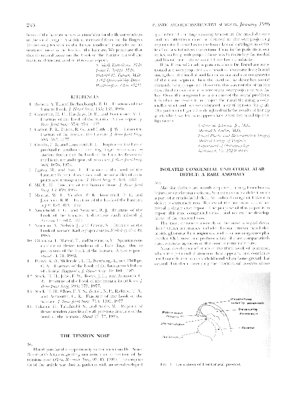 (PDF) Isolated Congenital Unilateral Alar Defect: A Rare Anomaly