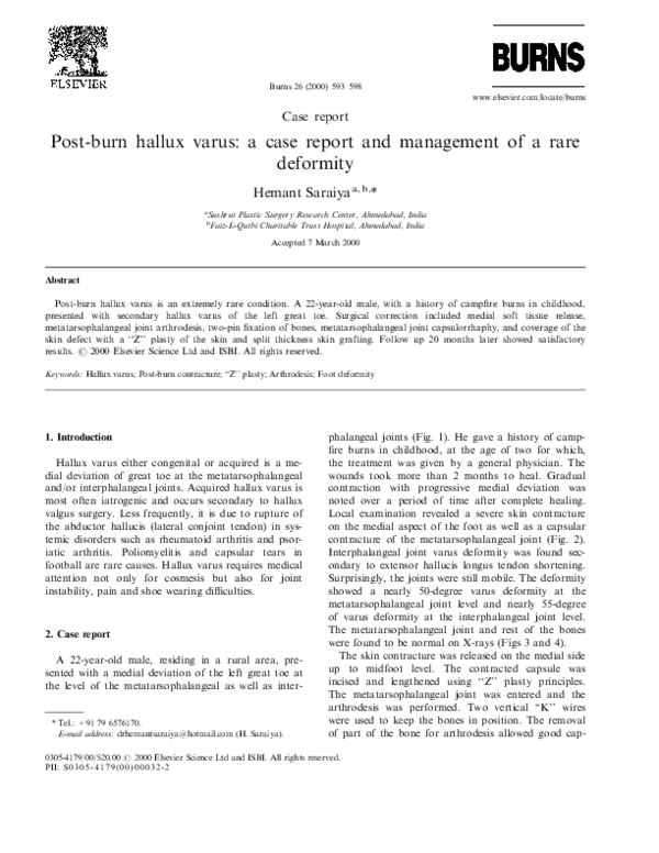 (PDF) Post-burn hallux varus: a case report and management of a rare ...