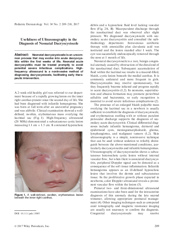 Pdf Usefulness Of Ultrasonography In The Diagnosis Of The Etiology Of Congenital