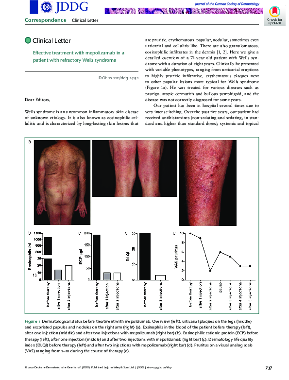 (PDF) Effective treatment with mepolizumab in a patient with refractory ...