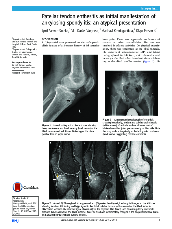 (PDF) Patellar tendon enthesitis as initial manifestation of ankylosing ...