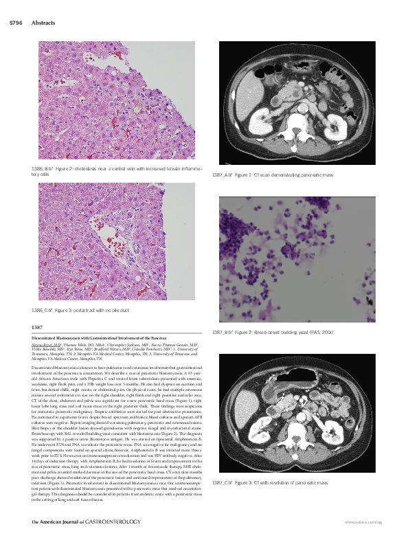 (PDF) Disseminated Blastomycosis with Gastrointestinal Involvement of ...