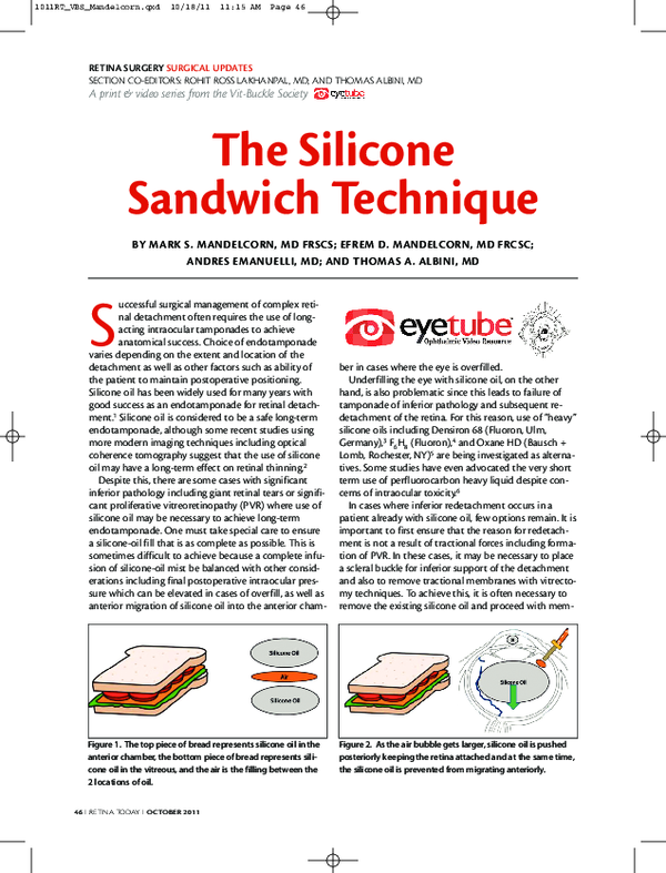 (PDF) The silicone sandwich technique