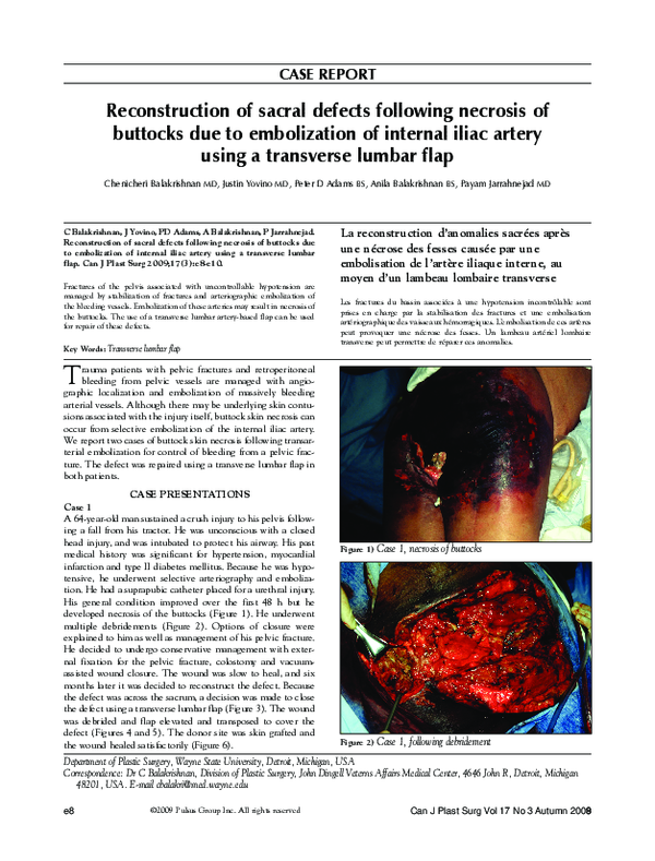 (PDF) Reconstruction of sacral defects following necrosis of buttocks ...