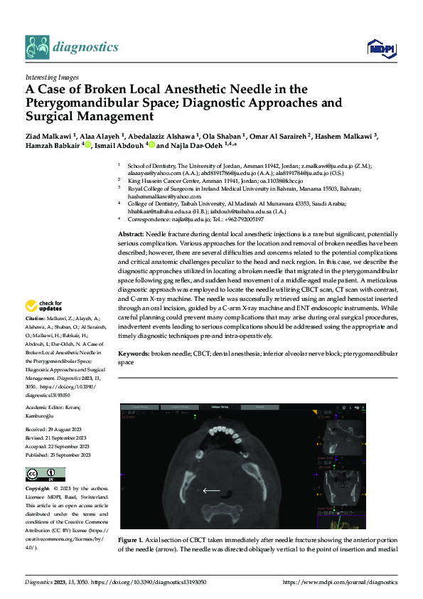 (PDF) A Case of Broken Local Anesthetic Needle in the Pterygomandibular ...