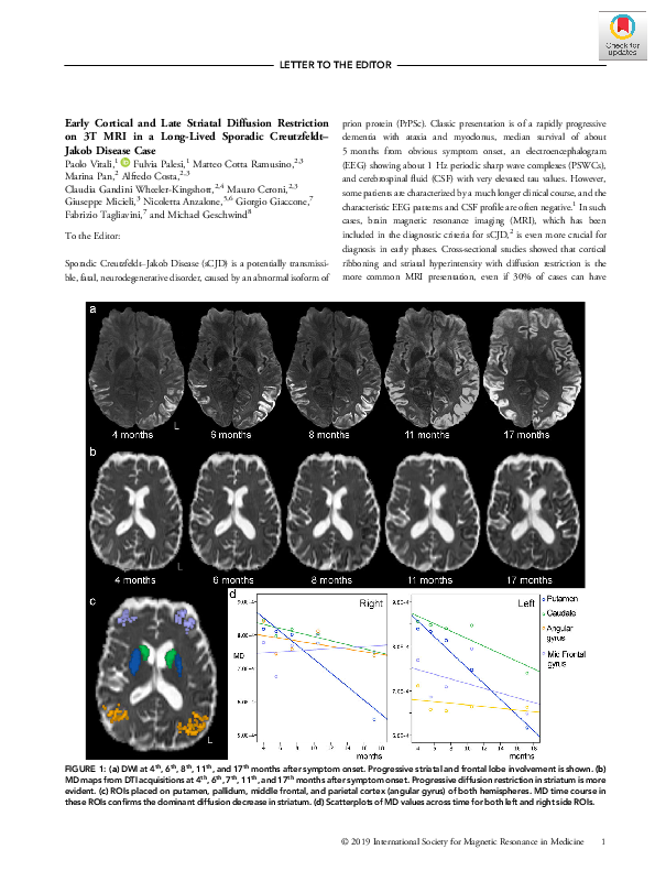 (PDF) Early cortical and late striatal diffusion restriction on 3T MRI ...