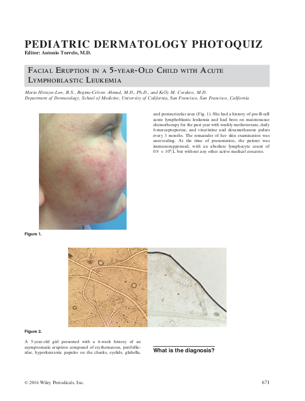 (PDF) Facial Eruption in a 5-year-Old Child with Acute Lymphoblastic ...