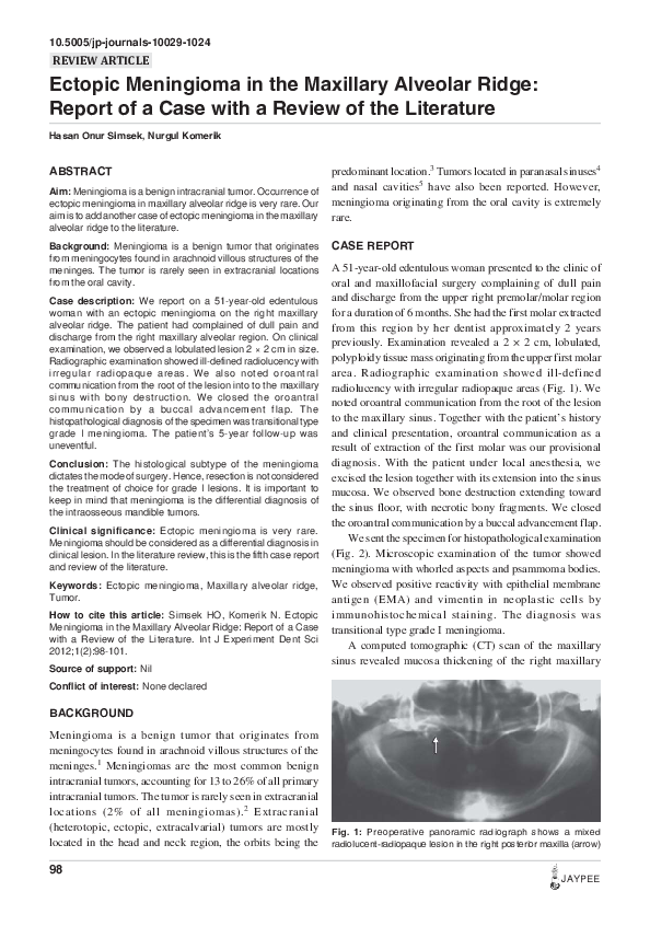 (PDF) Ectopic Meningioma in the Maxillary Alveolar Ridge: Report of a ...