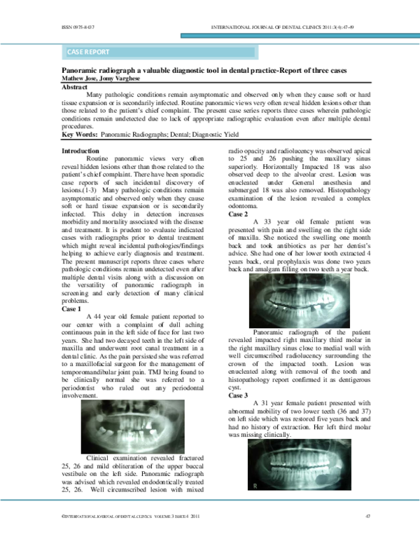 (PDF) Panoramic radiograph a valuable diagnostic tool in dental ...